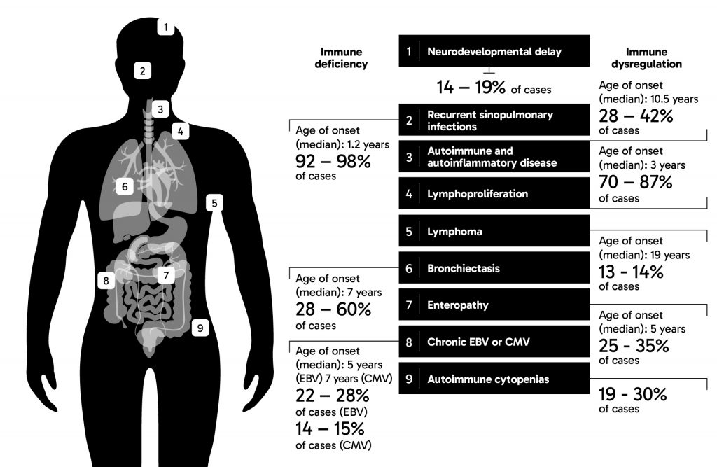 Diagnosing APDS | All About APDS